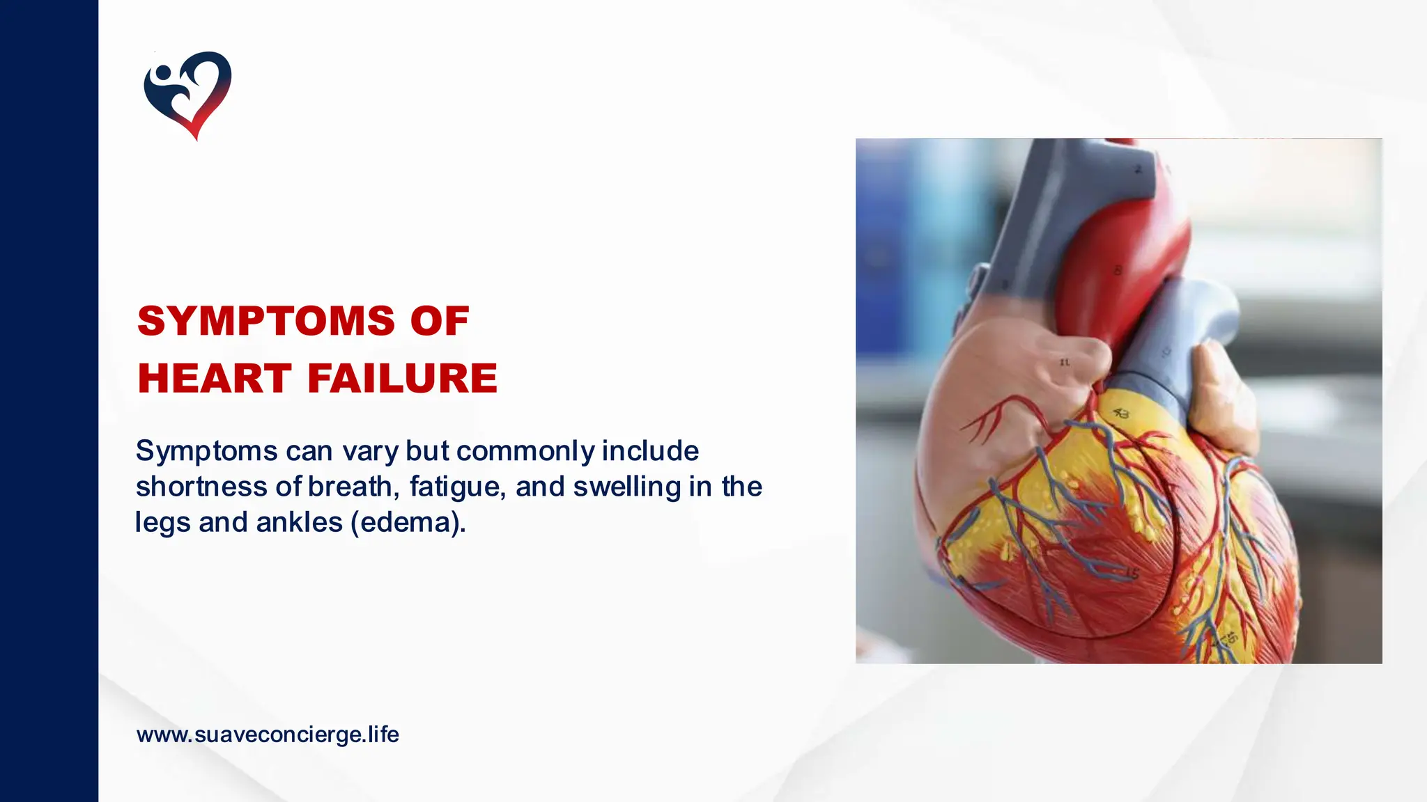 Understanding Heart Failure: Causes and Symptoms | PPTX