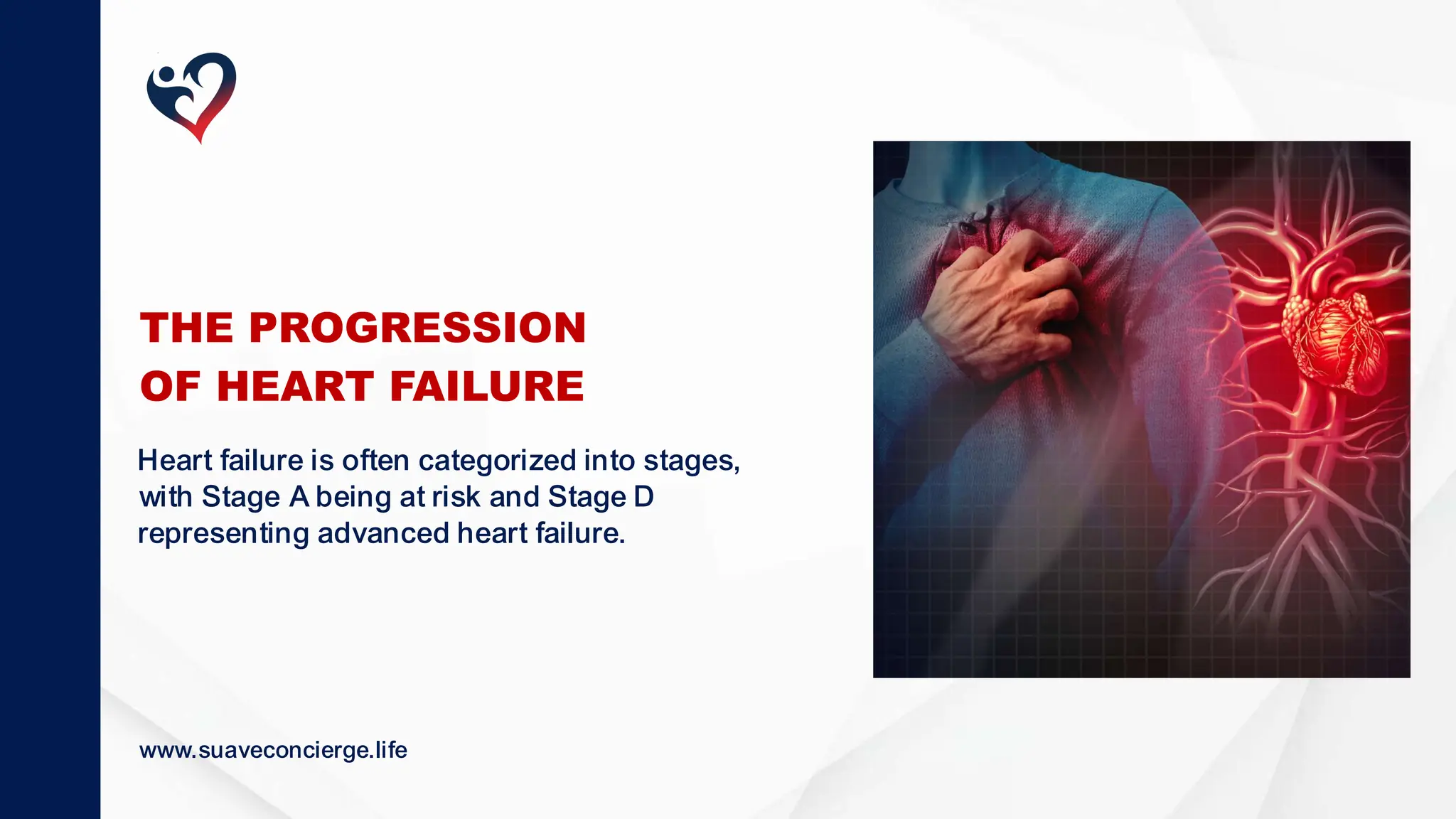 Understanding Heart Failure: Causes and Symptoms | PPTX