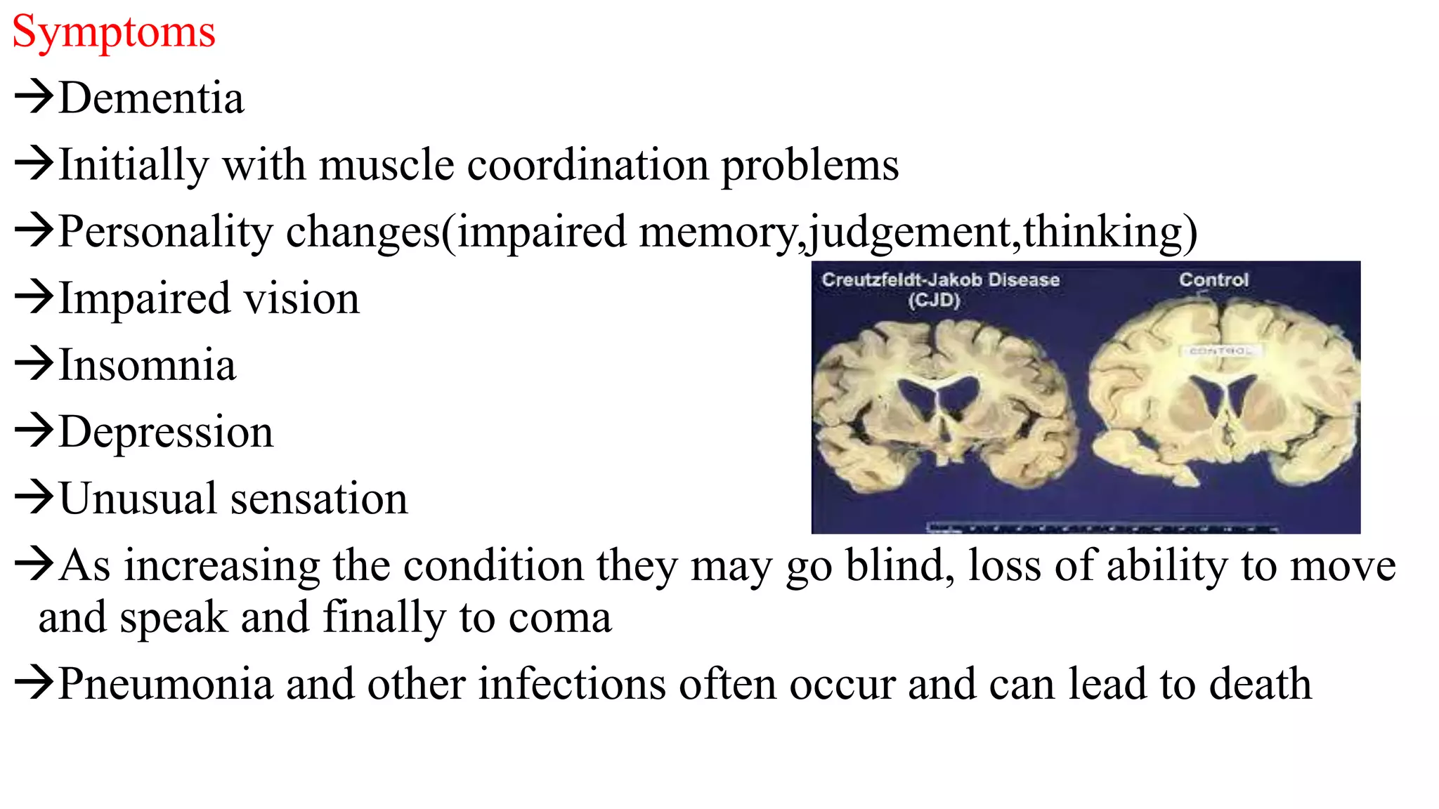 prion diseases(Scrapie and cjd) | PPTX