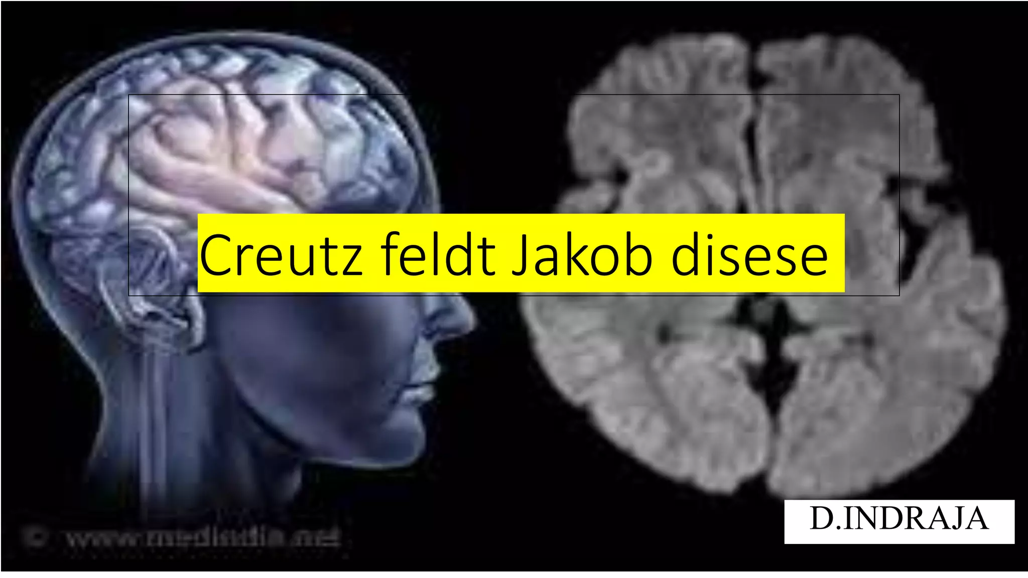 prion diseases(Scrapie and cjd) | PPTX