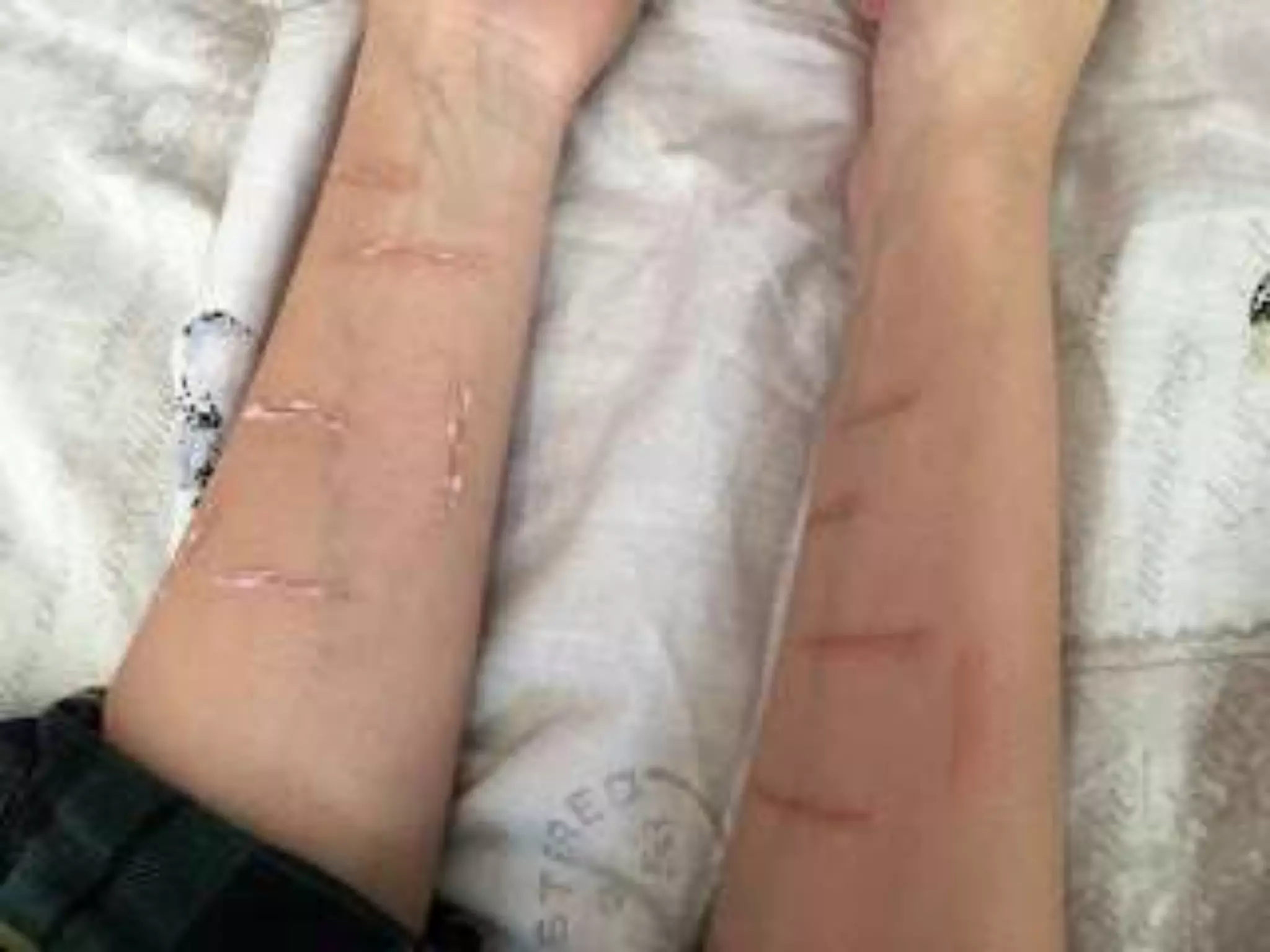 Scratches | PPTX