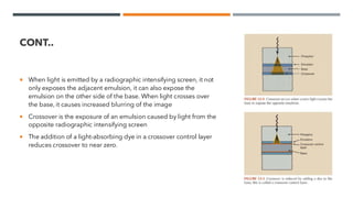 Understanding of Screen Film Radiography | PDF