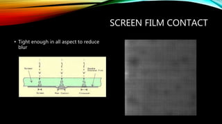 Radiographic Intensifying Screen | PPTX