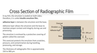 Screen flim radiography @deepanshu Laxkar (1).pdf