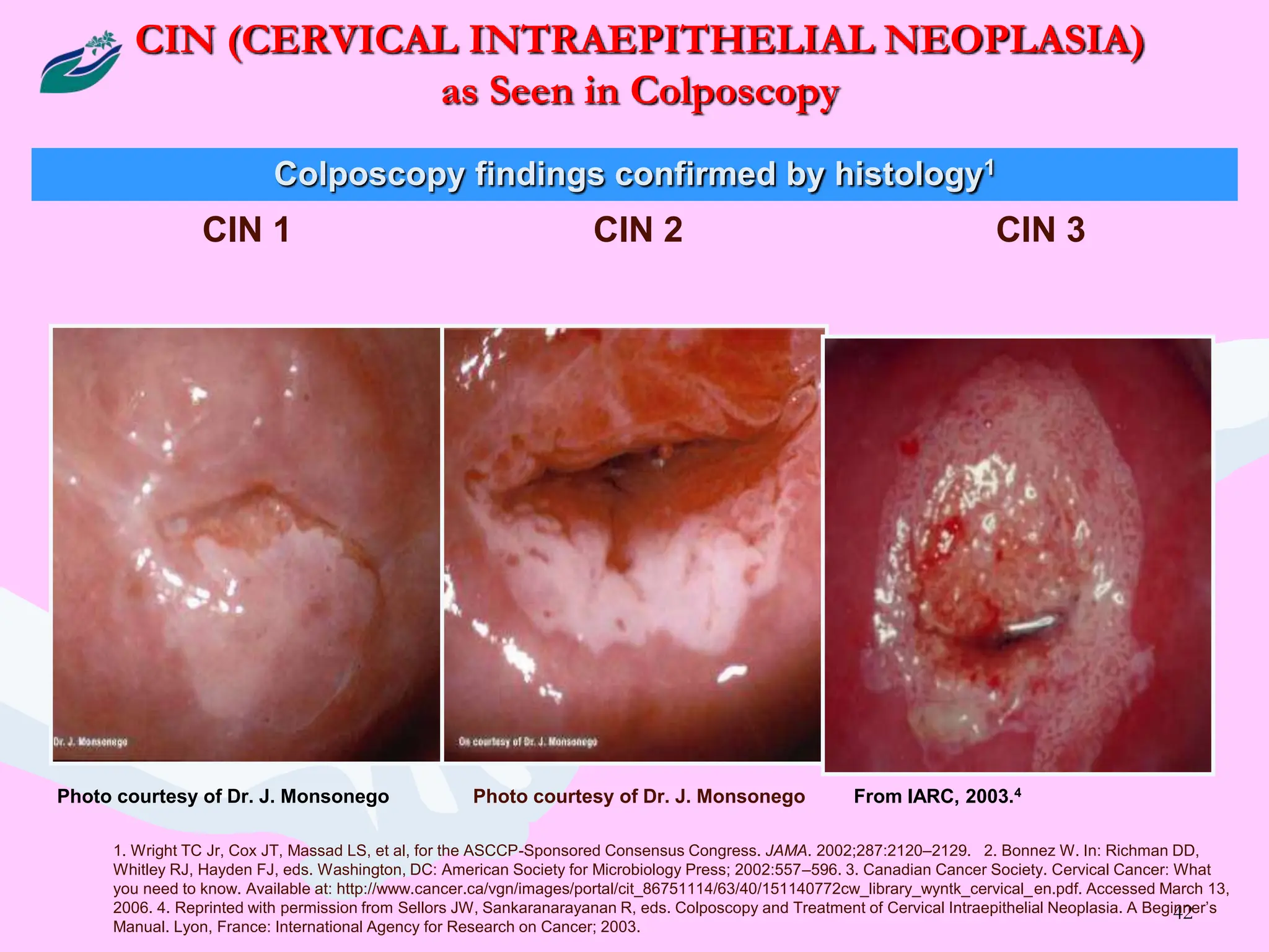 screening_and_prevention protocols for_cervix.ppt