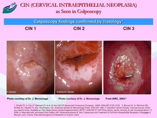 screening_and_prevention protocols for_cervix.ppt