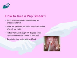 screening_and_prevention protocols for_cervix.ppt