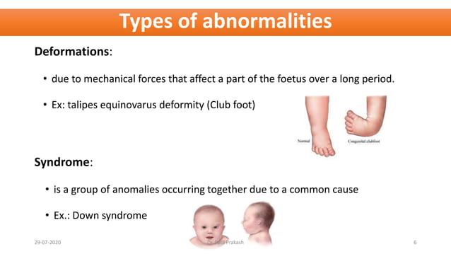 Genetic Testing in Neonates and Children - Screening for chromosomal ... Genetic Testing in Neonates and Children - Screening for chromosomal ...