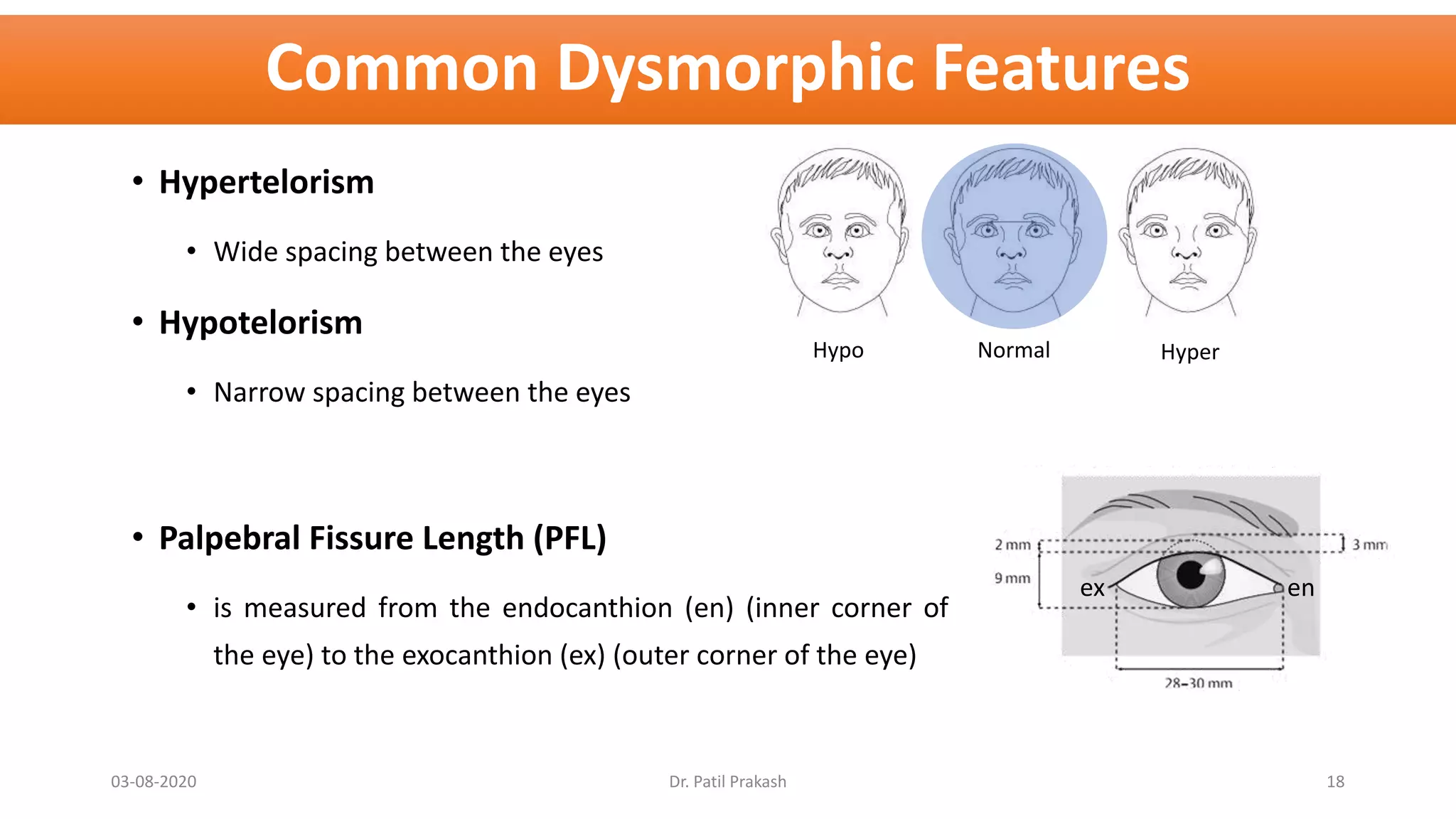 Genetic Testing in Neonates and Children - Screening for developmental ...