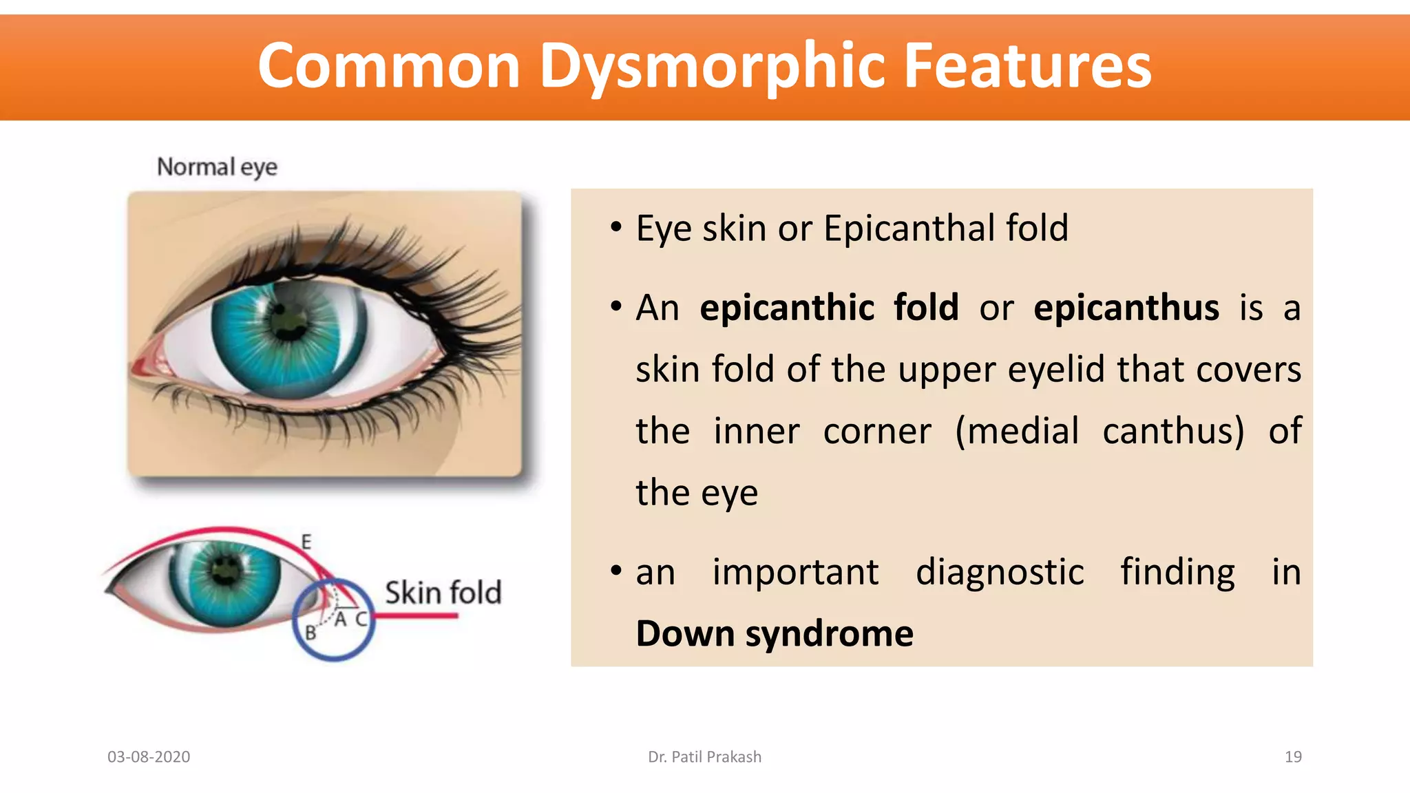 Genetic Testing in Neonates and Children - Screening for developmental ...
