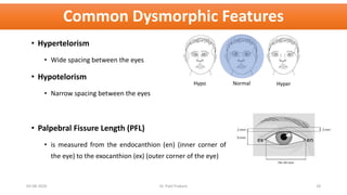 Genetic Testing in Neonates and Children - Screening for developmental ...