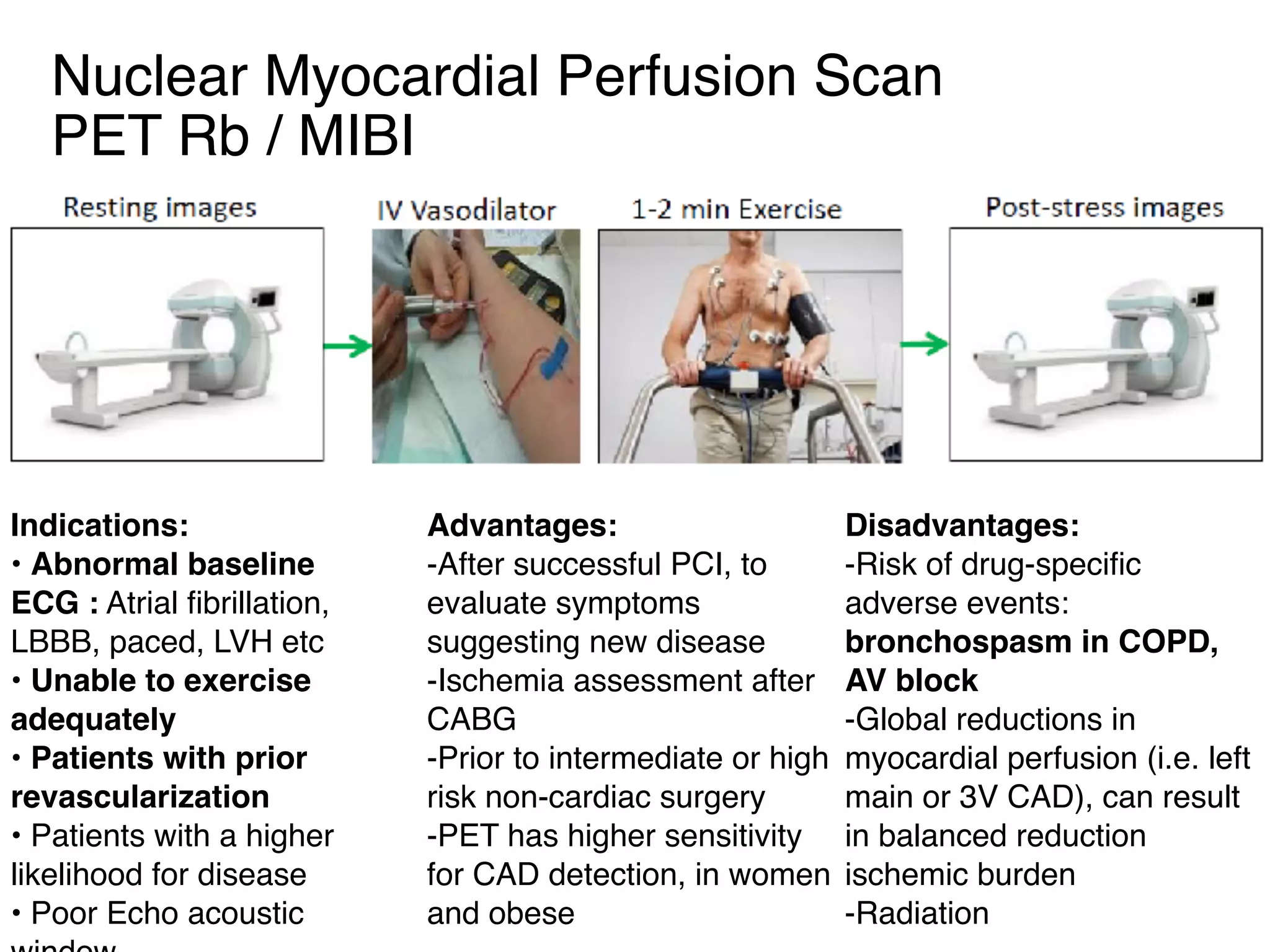 Cardiac Stress Test vs CT Coronary Angiogram: Which is better? | PDF