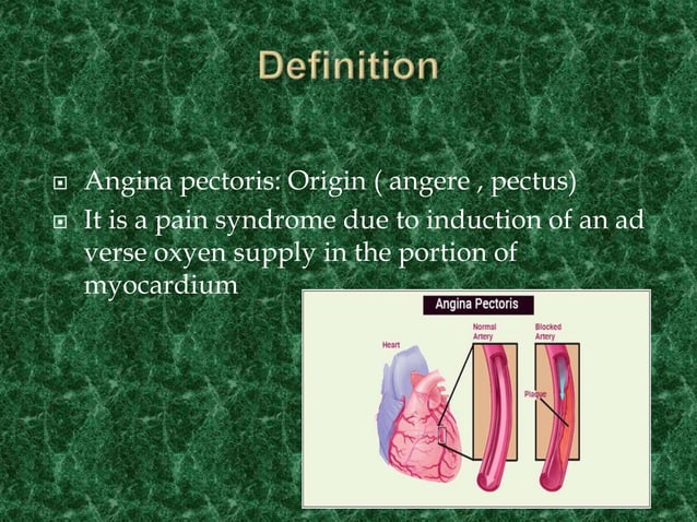 Screening methods for anti angina | PPTX | First Aid | Injuries