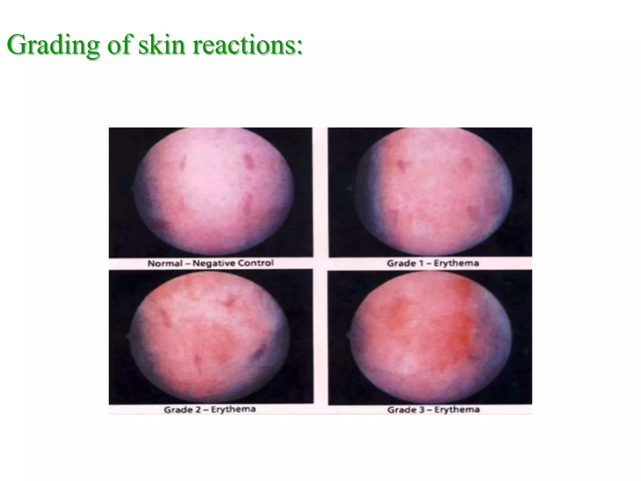 Screening methods for skin sensitization, skin irritation and dermal toxicity studies | PPTX