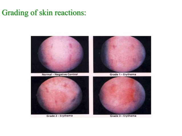 Screening methods for skin sensitization, skin irritation and dermal ...