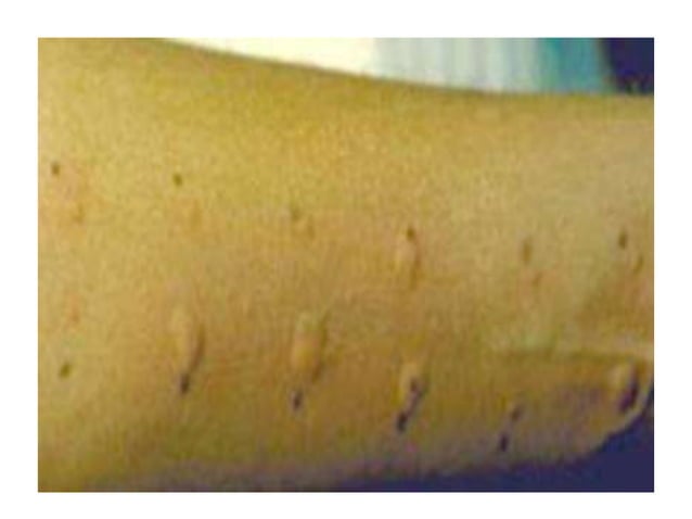 Screening methods for skin sensitization, skin irritation and dermal ...