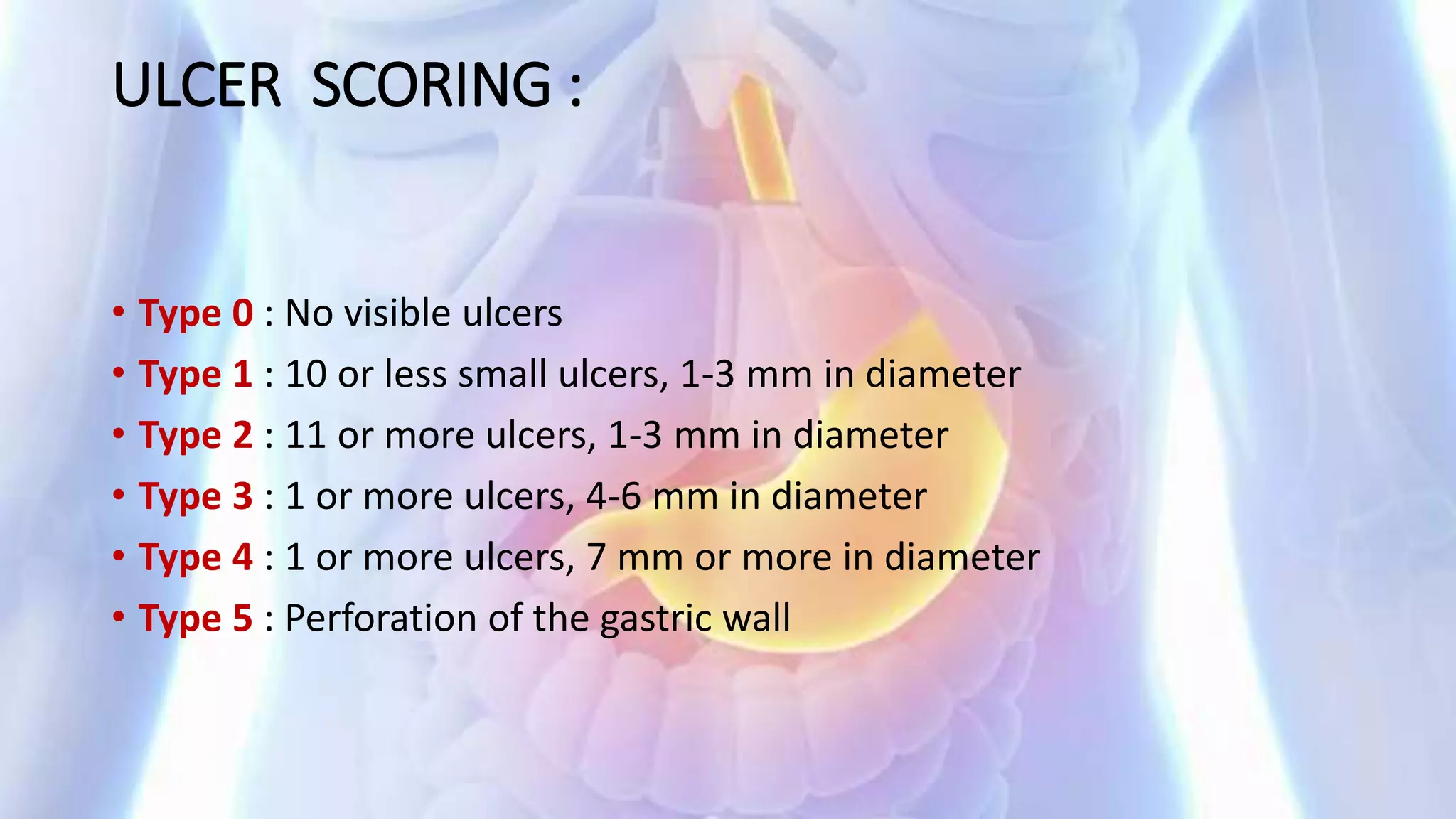 Screening methods for ulcer | PPTX