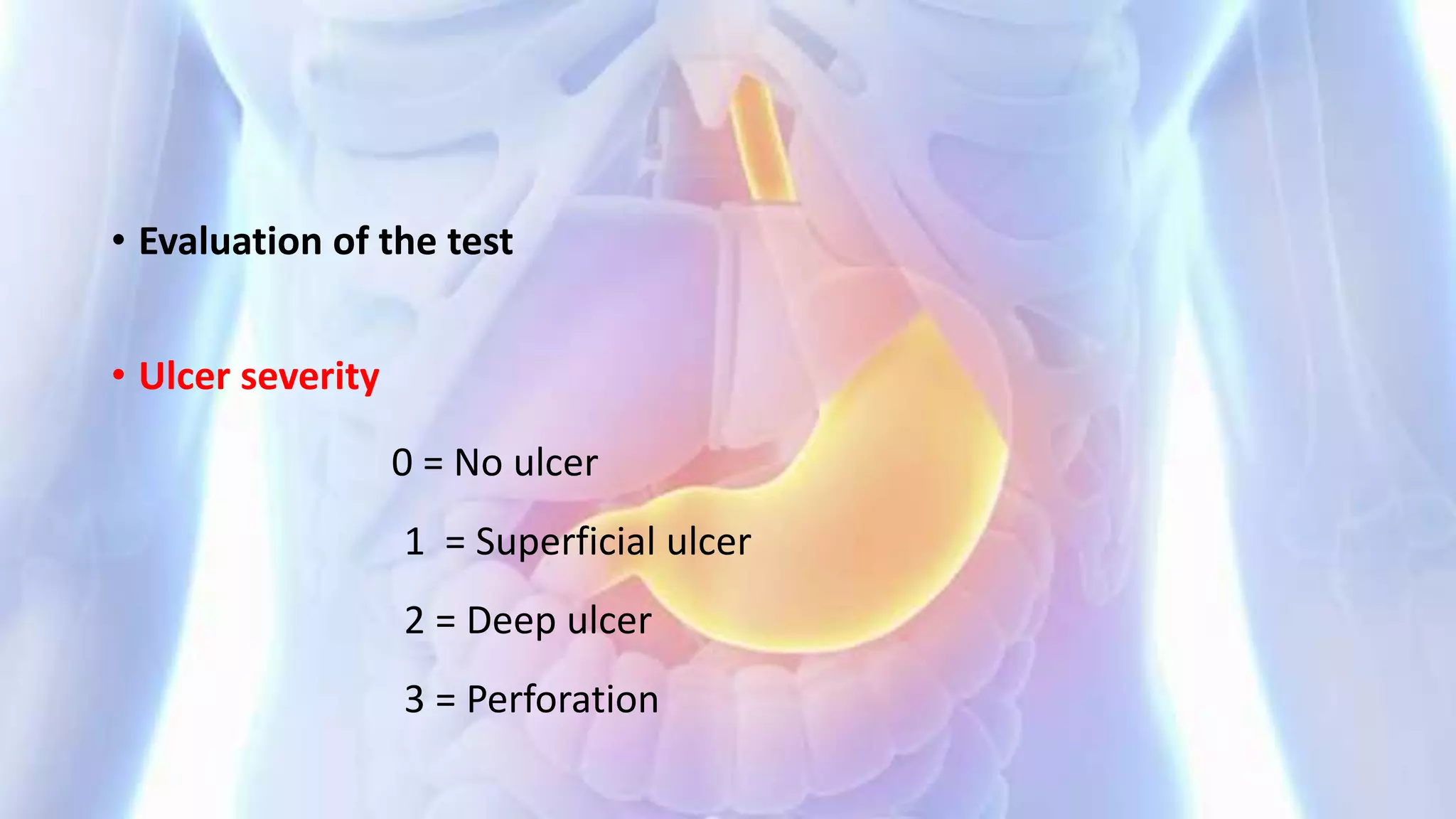 Screening methods for ulcer | PPTX