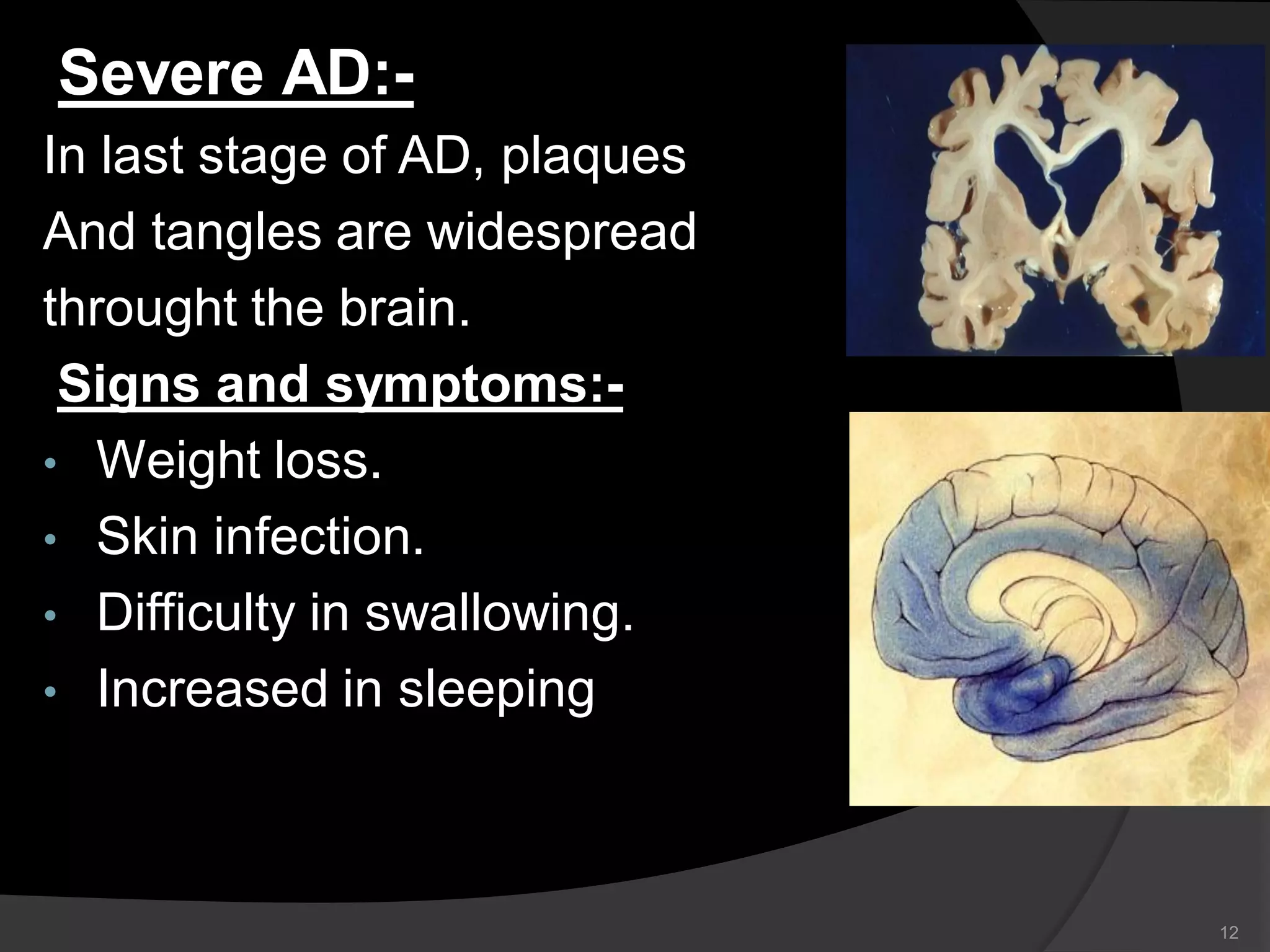 Screening models of alzheimer disease | PDF