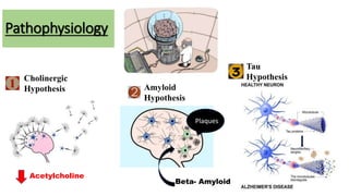 Screening Models of Alzheimers disease.pptx