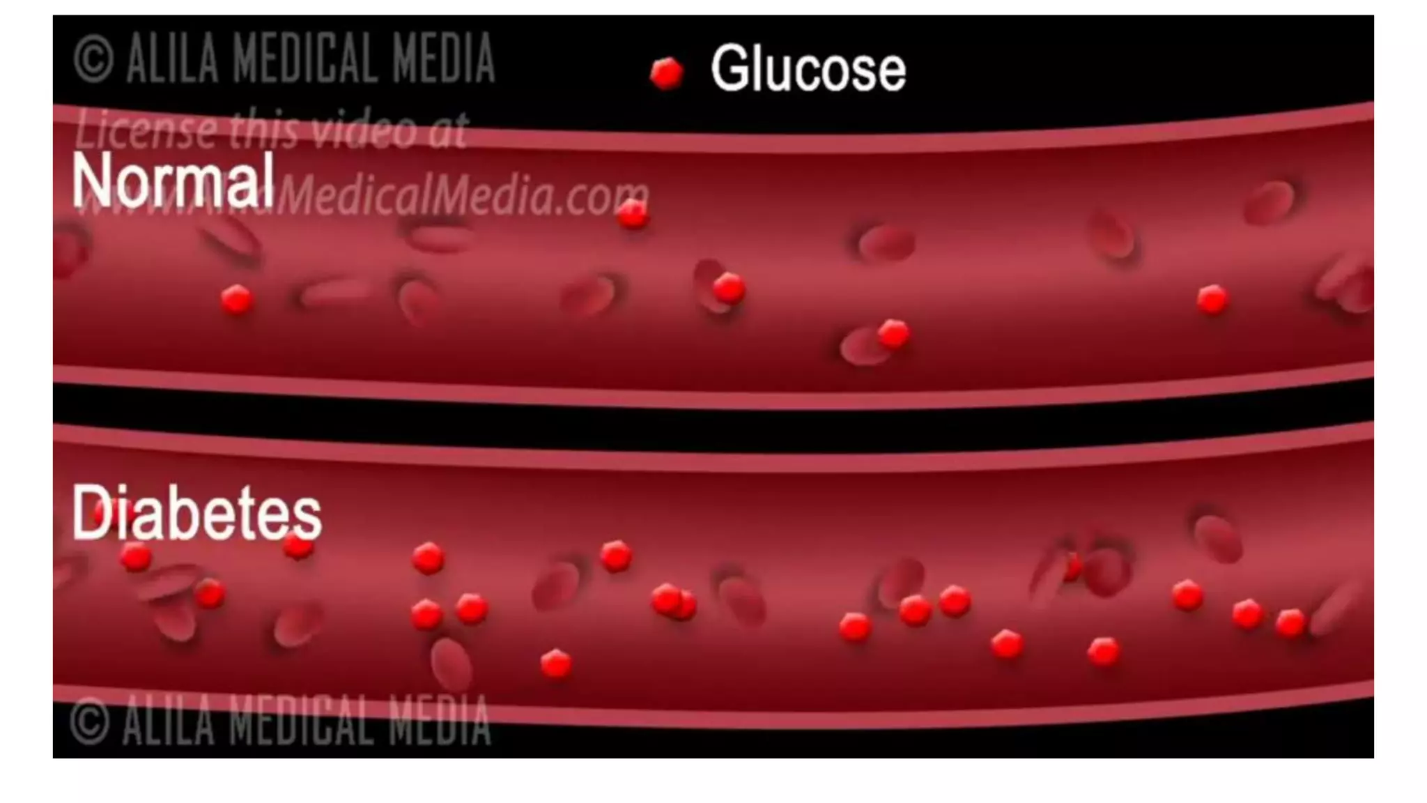 Screening Models for Anti-Diabetic Drugs. | PPTX