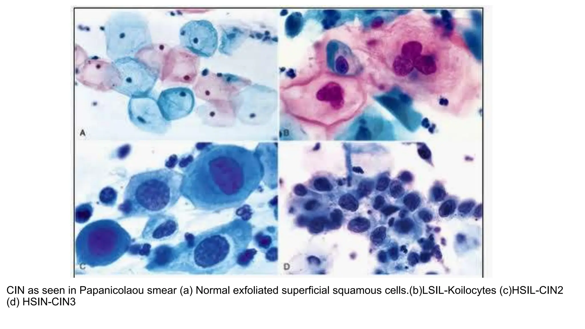 Screening of cervical cancer ppt for mbbs | PPTX