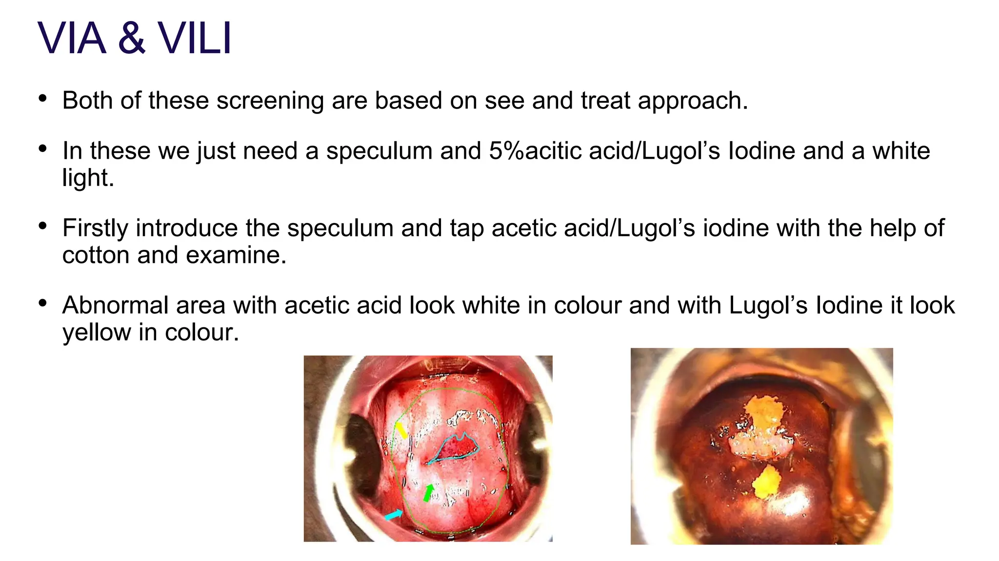 Screening of cervical cancer ppt for mbbs | PPTX