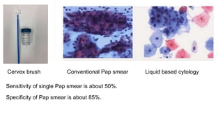 Screening of cervical cancer ppt for mbbs | PPTX | Medical Tests ...