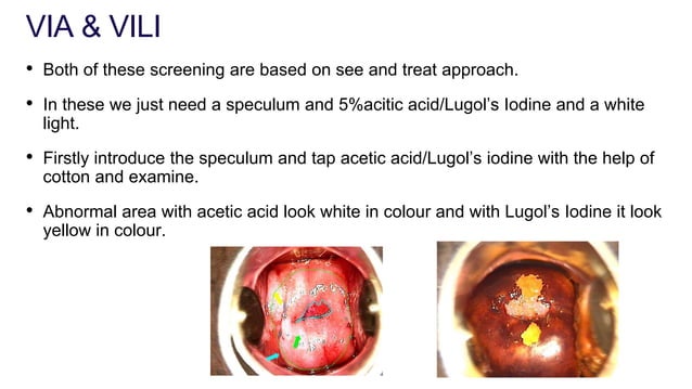Screening of cervical cancer ppt for mbbs | PPTX | Medical Tests ...