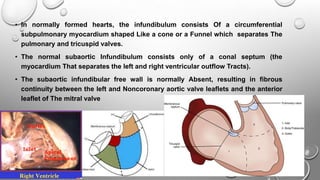 Screening of congenital heart disease | PPTX