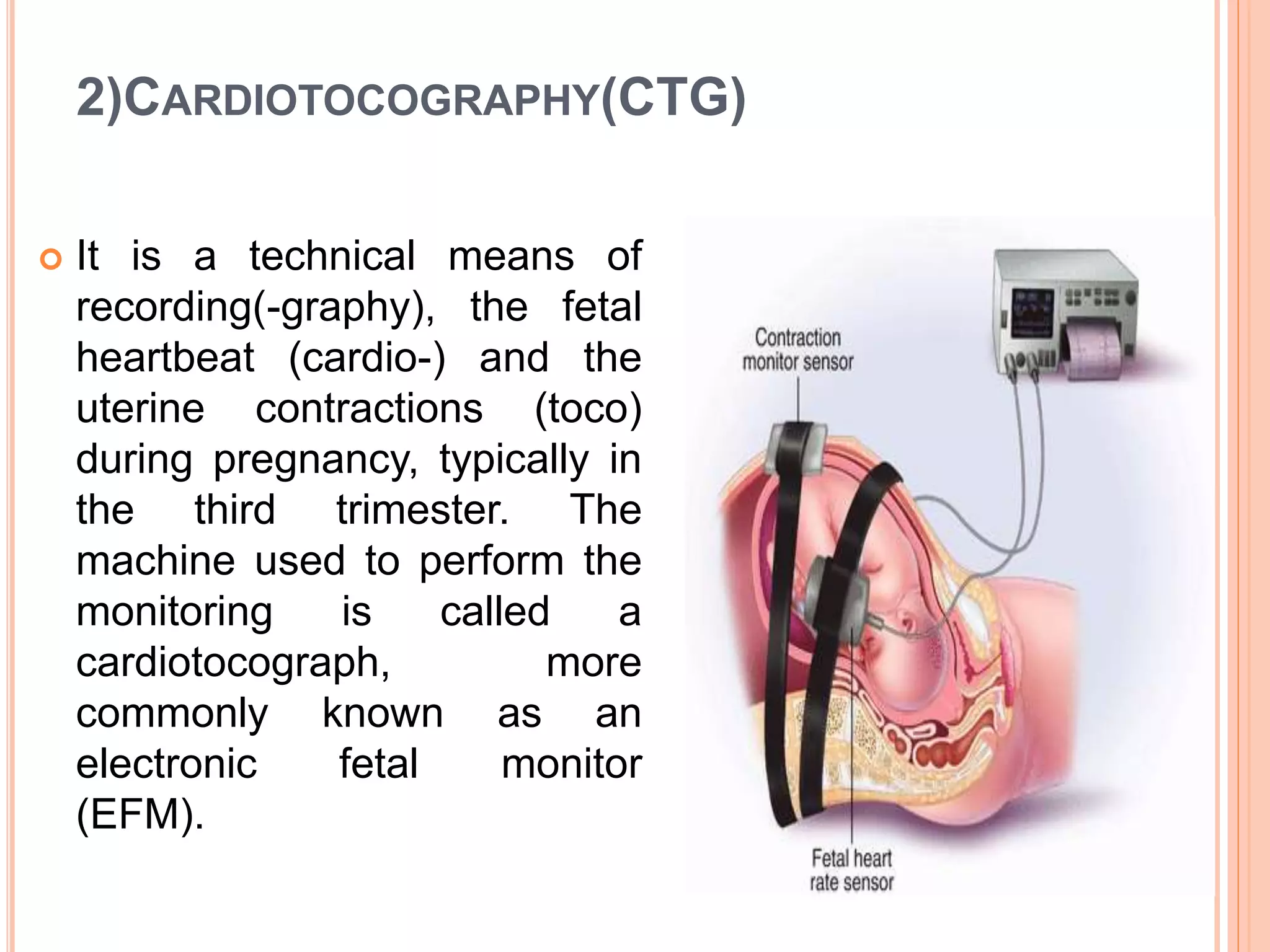 SCREENING OF HIGH RISK PREGNANCY NEWER MODALITIES OF_110313.pptx