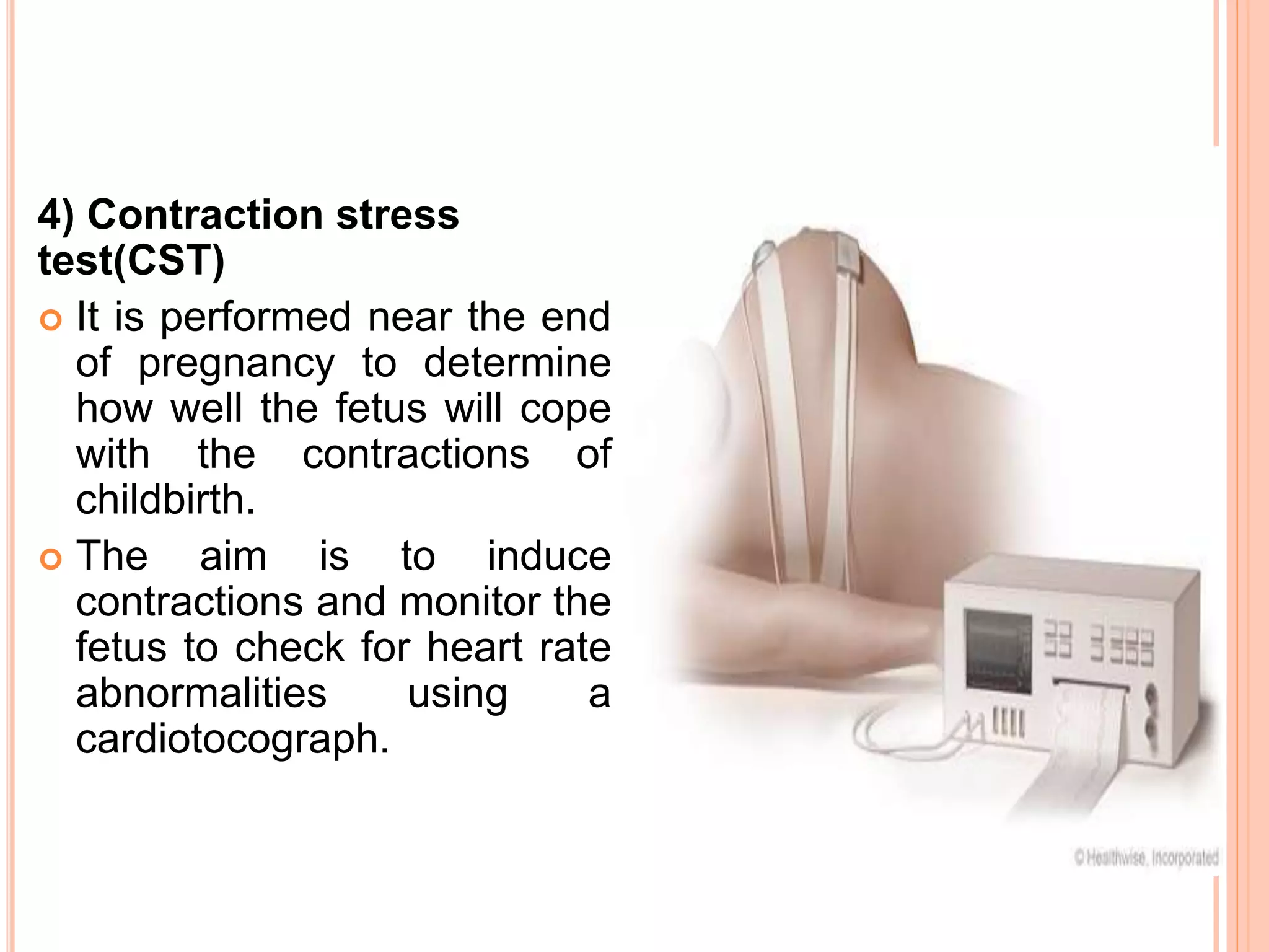 SCREENING OF HIGH RISK PREGNANCY NEWER MODALITIES OF_110313.pptx