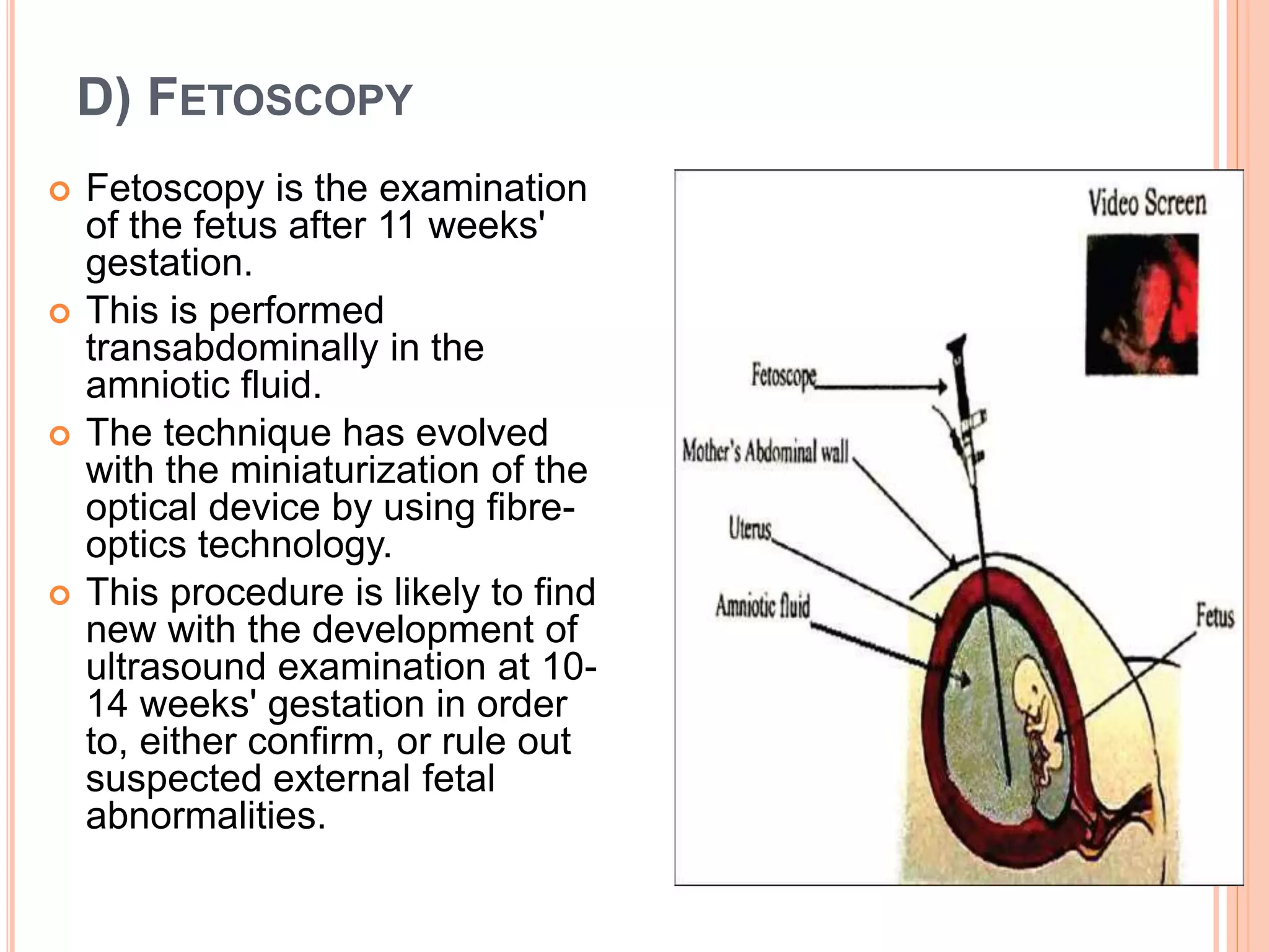 SCREENING OF HIGH RISK PREGNANCY NEWER MODALITIES OF_110313.pptx