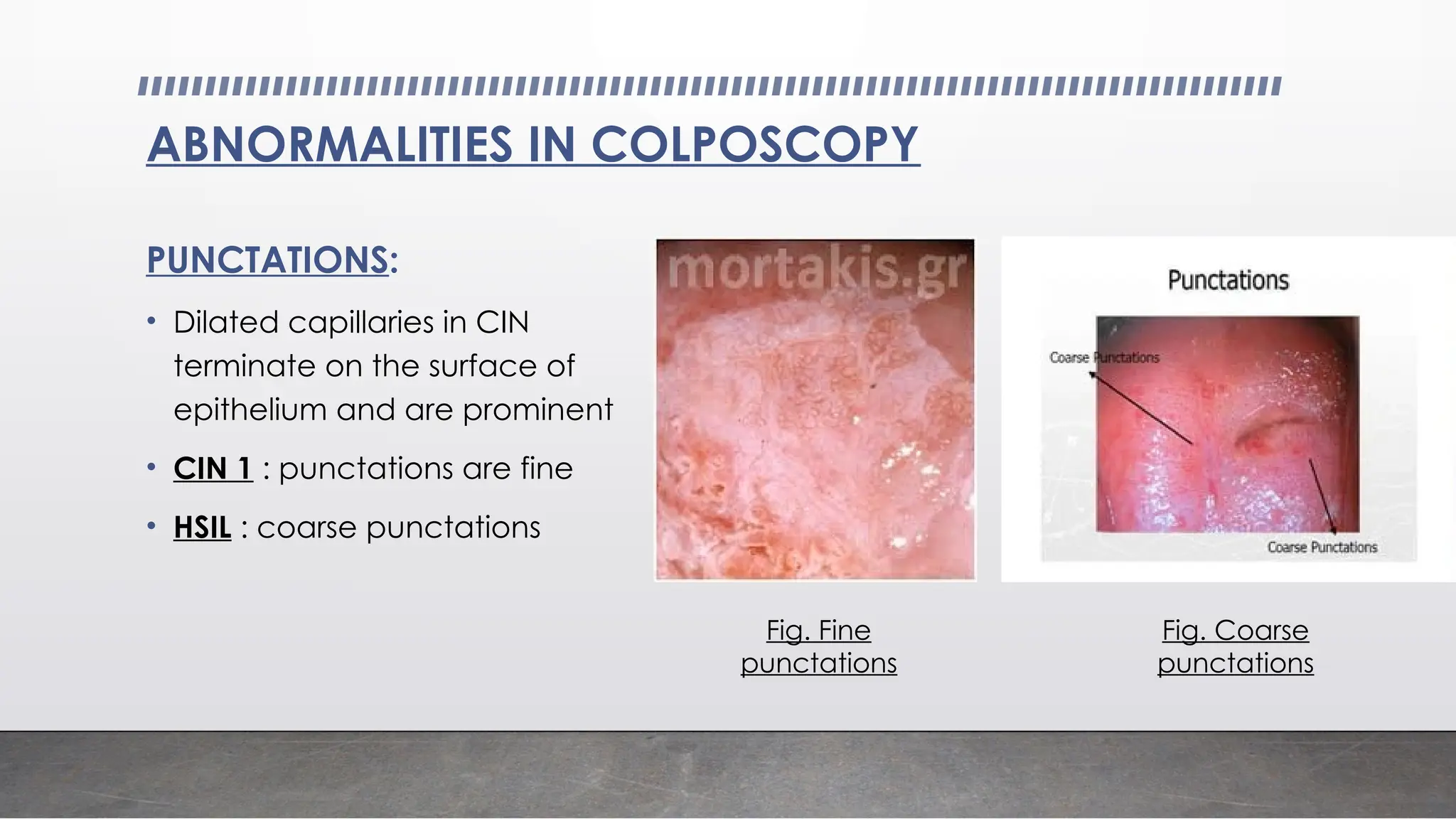 SCREENING & PREVENTION OF CANCER CERVIX.pptx