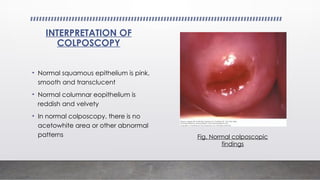 SCREENING & PREVENTION OF CANCER CERVIX.pptx