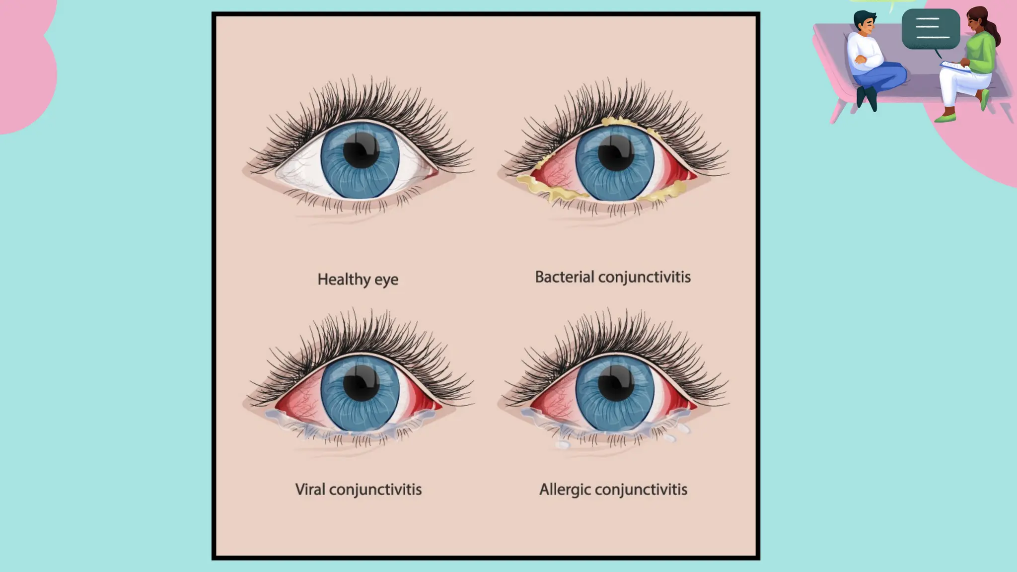 Conjunctivitis I Screening I Management I | PPT