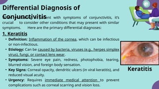 Conjunctivitis I Screening I Management I | PPT