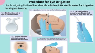 Conjunctivitis I Screening I Management I | PPT