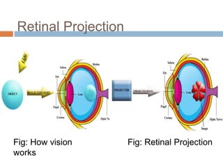 Screenless displays: visualimage, retinaldisplay,synapticdisplays | PPTX
