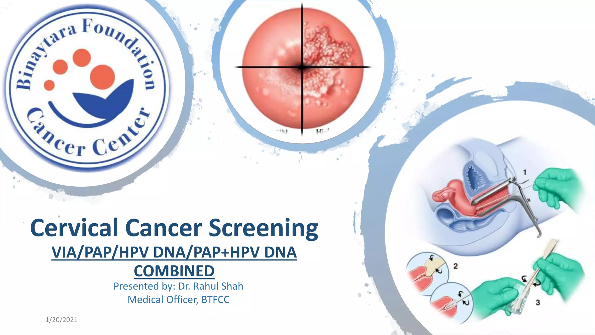 Cervical Cancer Screening Modalities | PPTX
