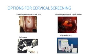 Cervical Cancer Screening Modalities | PPTX