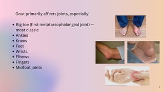 Gout - introduction, etiology, stages, types and prevention | PDF