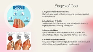 Gout - introduction, etiology, stages, types and prevention | PDF