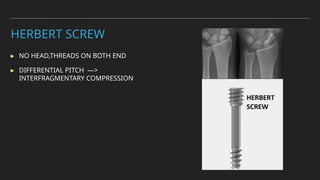 SCREW IN ORTHOPAEDICS SURGERY PRESENTATION.pptx | Bone and Joint ...