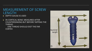 SCREW IN ORTHOPAEDICS SURGERY PRESENTATION.pptx | Bone and Joint ...