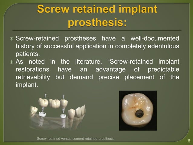 Screw retained vs cement retained prosthesis.pptx