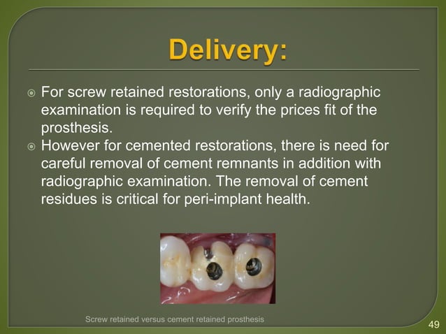 Screw retained vs cement retained prosthesis.pptx