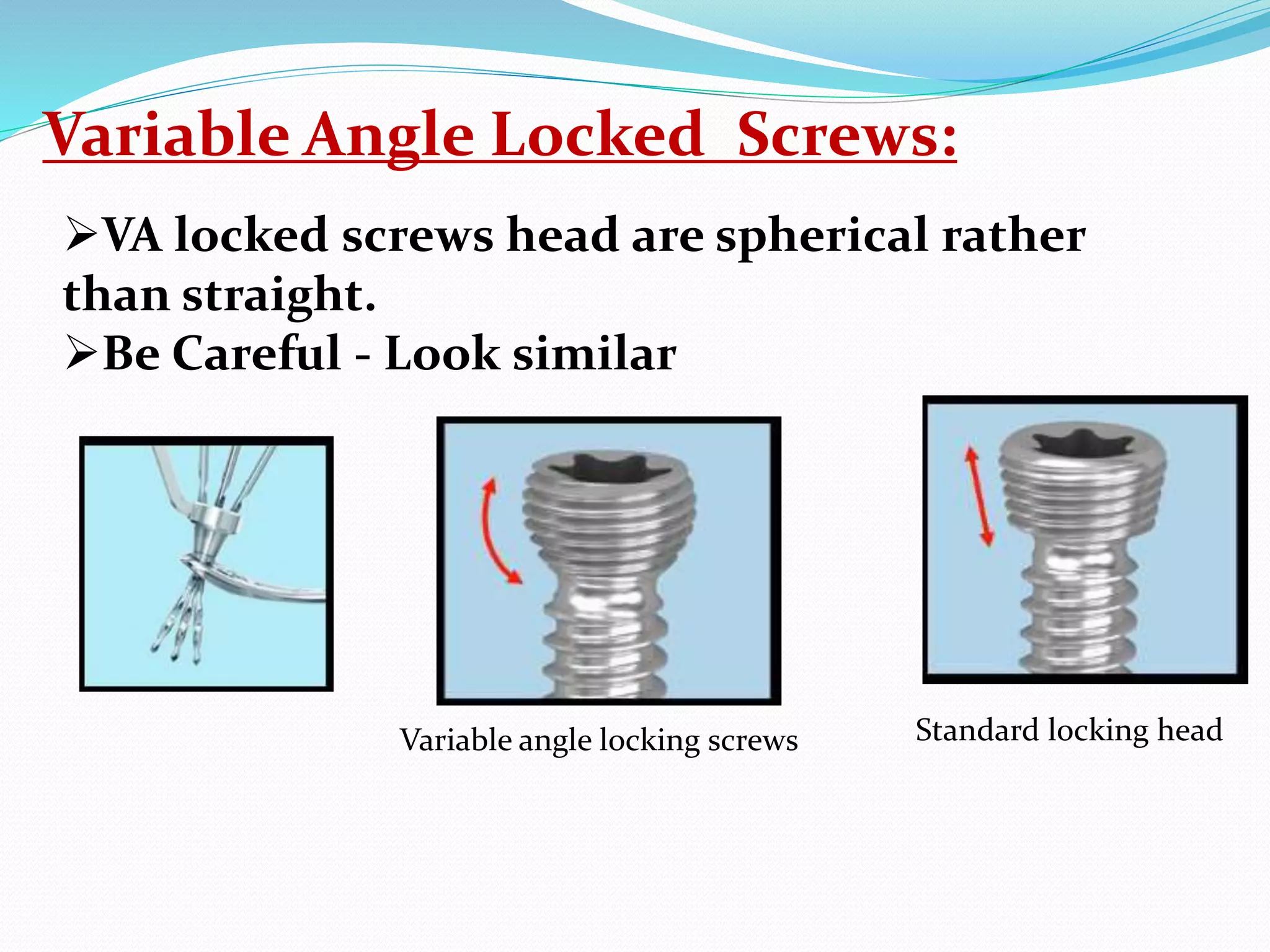 SCREWS in orthopaedic surgery.pptx