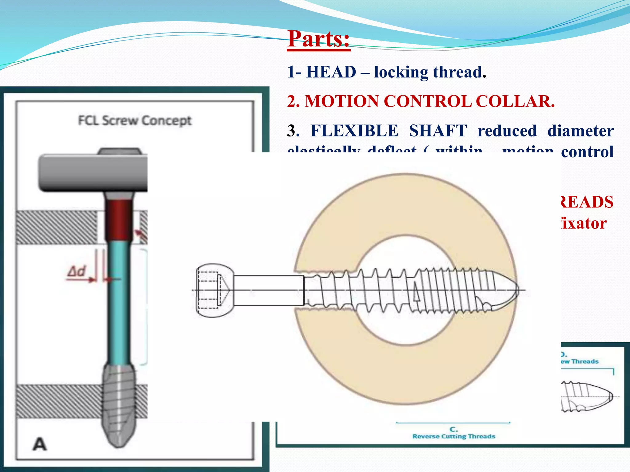 SCREWS in orthopaedic surgery.pptx