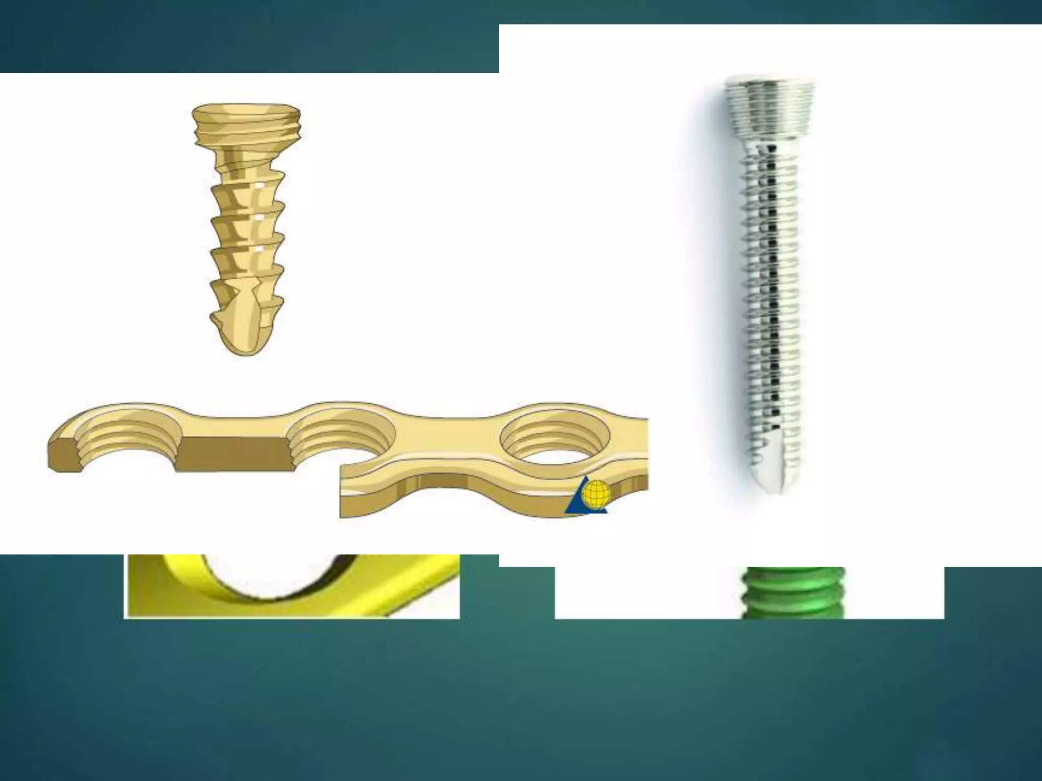 SCREWS in orthopaedic surgery.pptx